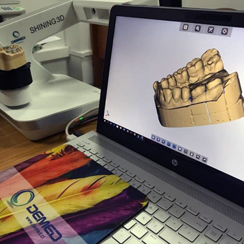3d Scanning Service 3d Gadgets Malaysia 3d Printing Scanning Services